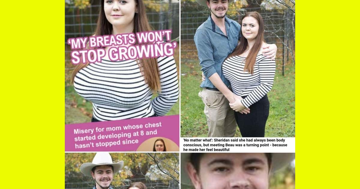 The headline is "my breasts won't stop growing" but what makes it, is ...