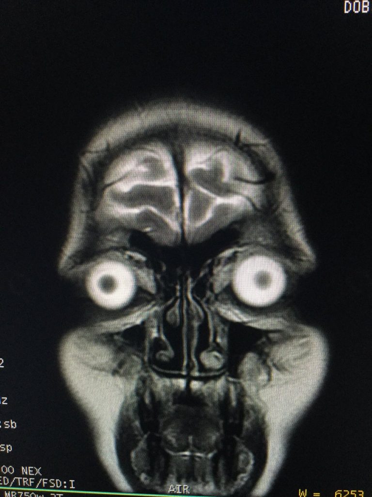 The MRI scan of this pug will haunt your dreams - The Poke