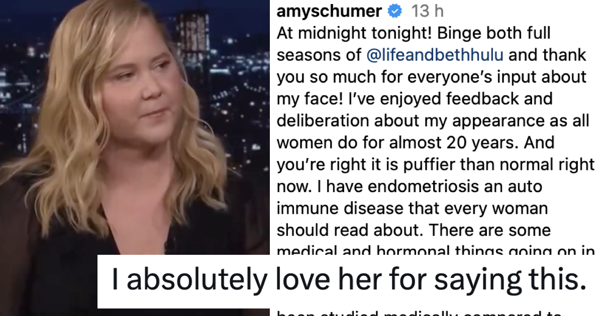 Amy Schumer had the very best response to trolls wanging on about her ...